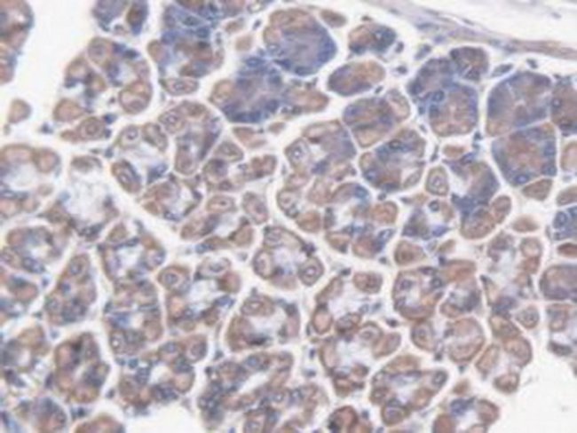 CRISP1 Polyclonal Antibody, Invitrogen 20 μL; Unconjugated:Antibodies ...
