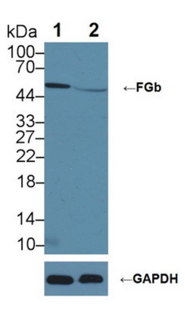 Invitrogen Fibrinogen Beta Chain Polyclonal Antibody 20 μL ...