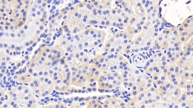 HFE2 Polyclonal Antibody, Invitrogen 20 μL; Unconjugated:Antibodies ...
