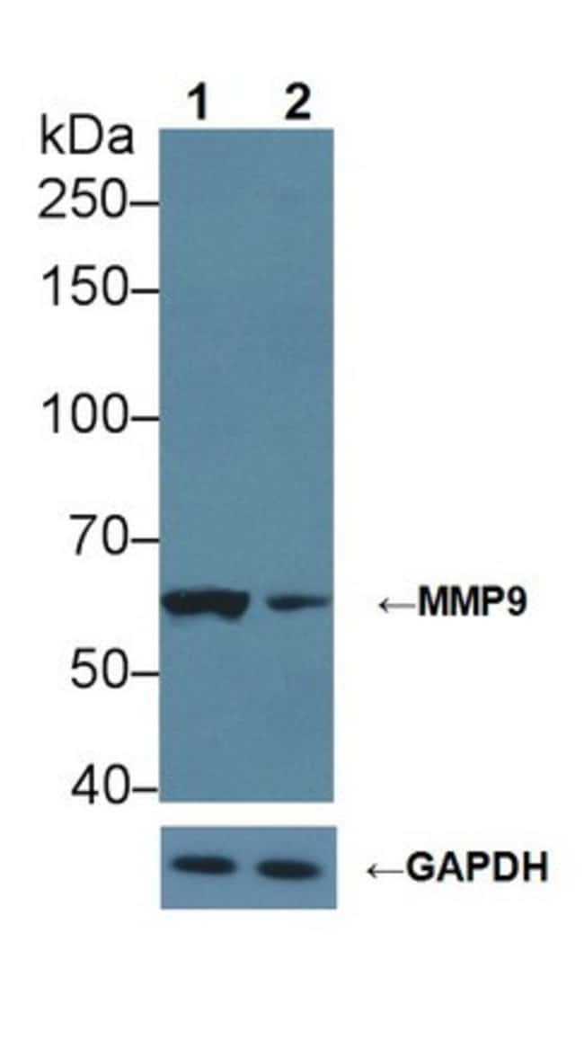 MMP9 Polyclonal Antibody, Invitrogen 20 μL; Unconjugated:Anticuerpos ...