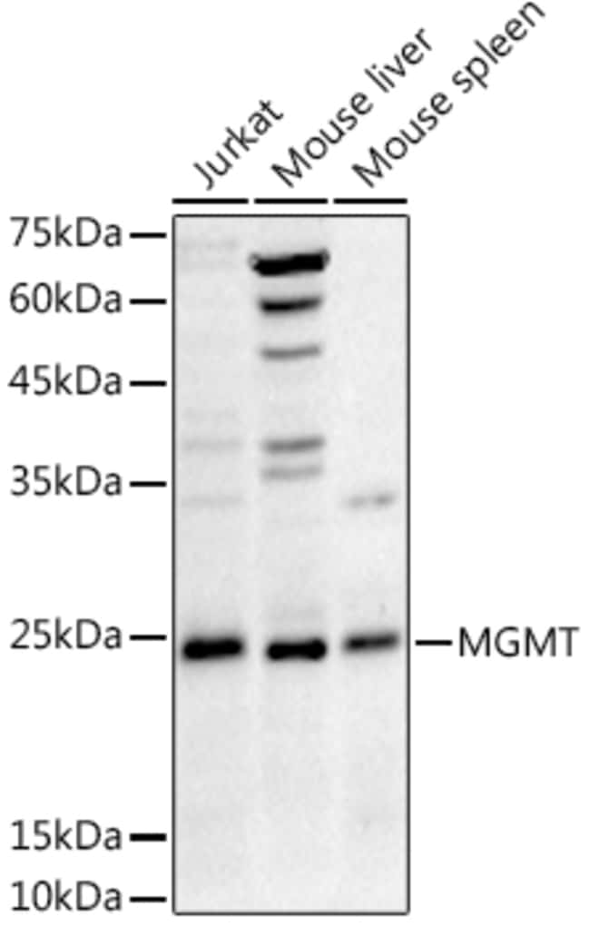 Invitrogen MGMT Polyclonal Antibody 100 μL; Unconjugated:Antibodies ...