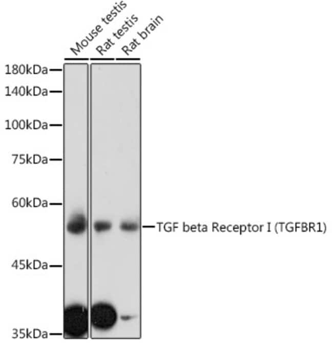 TGFBR1 Polyclonal Antibody, Invitrogen 100 μL; Unconjugated:Antibodies ...