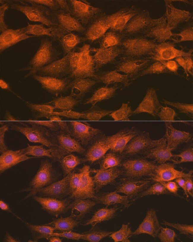 Invitrogen IKK gamma Polyclonal Antibody 100 μL | Buy Online ...