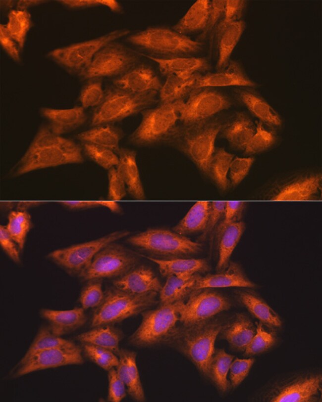 Invitrogen IKK gamma Polyclonal Antibody 100 μL; Unconjugated ...