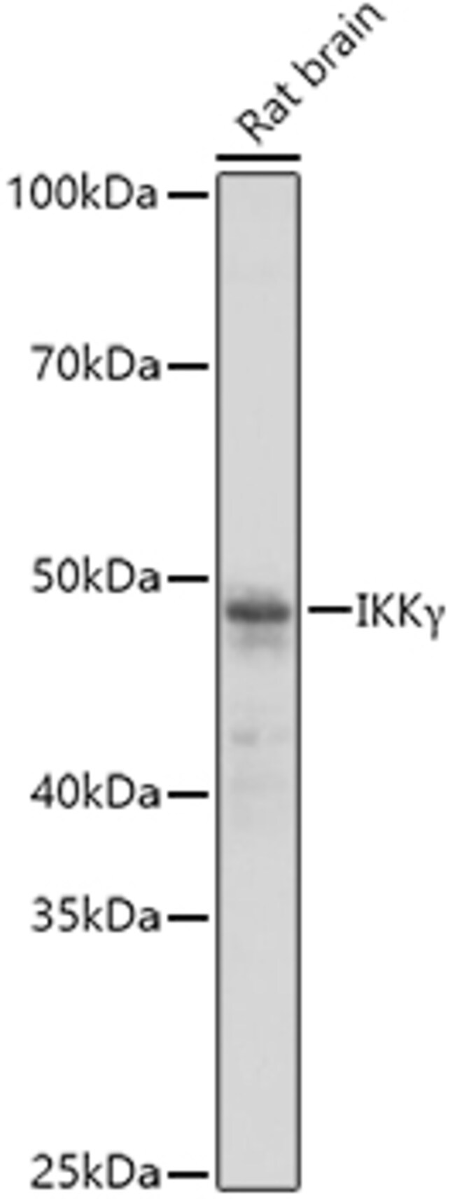 Invitrogen IKK gamma Polyclonal Antibody 100 μL | Buy Online ...