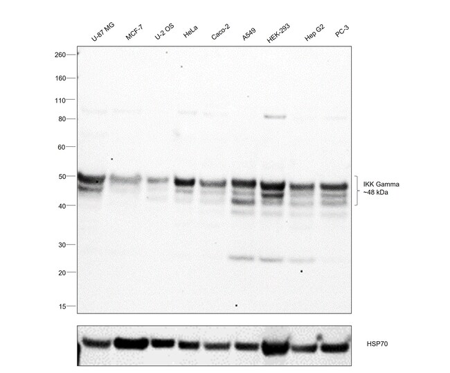 Invitrogen IKK gamma Polyclonal Antibody 100 μL | Buy Online ...