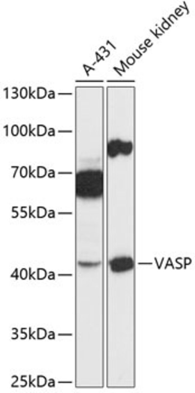 VASP Polyclonal Antibody, Invitrogen™ 100 μL; Unconjugated | Fisher ...