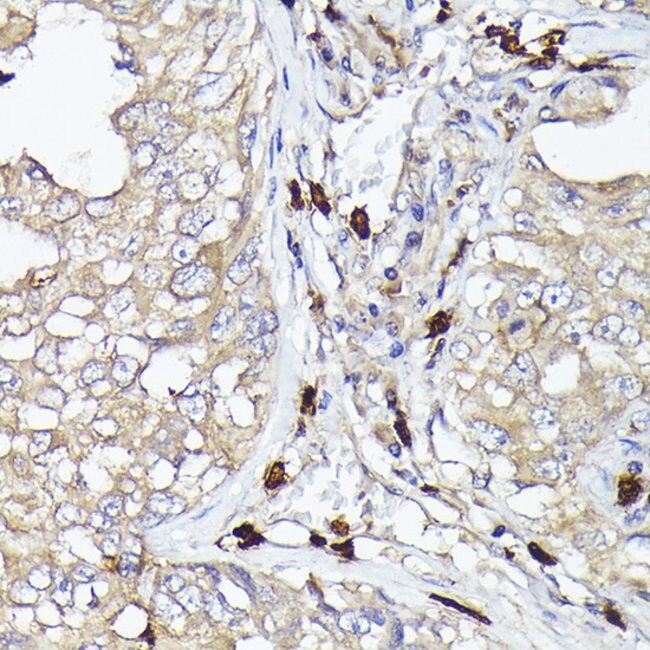 S100A9 Polyclonal Antibody, Invitrogen 100 μL; Unconjugated:Antibodies ...