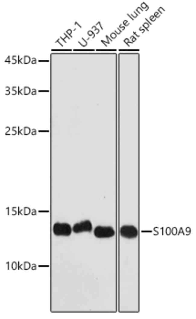 S100A9 Polyclonal Antibody, Invitrogen 100 μL; Unconjugated:Antibodies, | Fisher Scientific