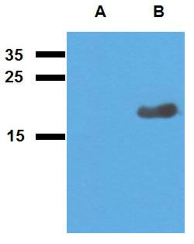 Mycobacterium tuberculosis Acr2 Polyclonal Antibody, Invitrogen 100 μg ...