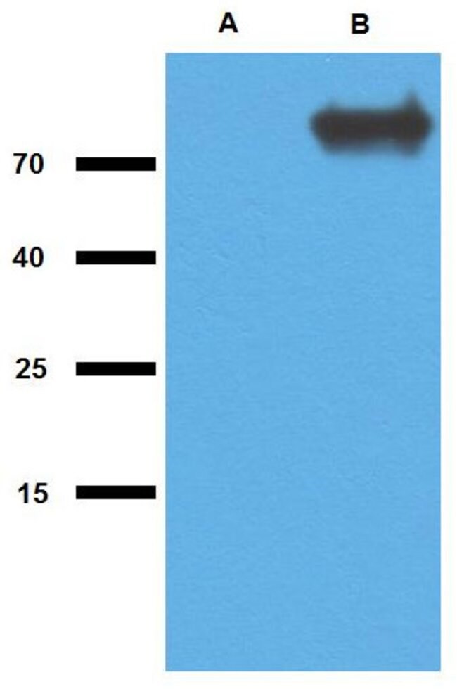 Mycobacterium tuberculosis GlcB Polyclonal Antibody, Invitrogen 100 μg ...