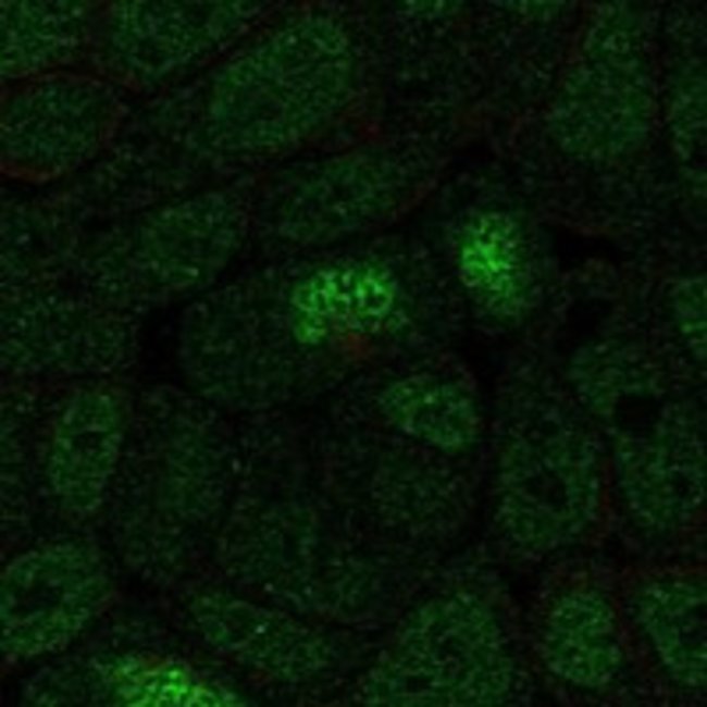 HOXA13 Polyclonal Antibody, Invitrogen 100 μL; Unconjugated:Antibodies ...