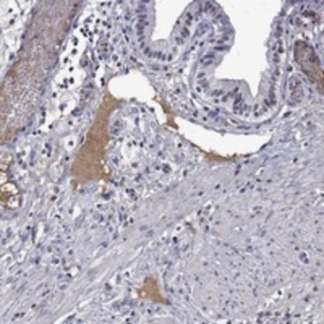 ApoA2 Polyclonal Antibody, Invitrogen 100 μL; Unconjugated:Antibodies ...