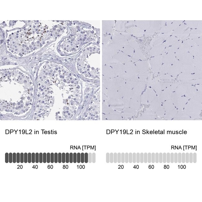 DPY19L2 Polyclonal Antibody, Invitrogen 100 μL; Unconjugated:Antibodies, | Fisher Scientific