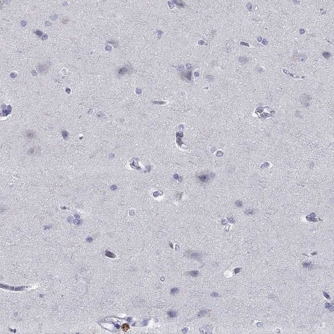 CD103 (Integrin alpha E) Polyclonal Antibody, Invitrogen 100 μL ...