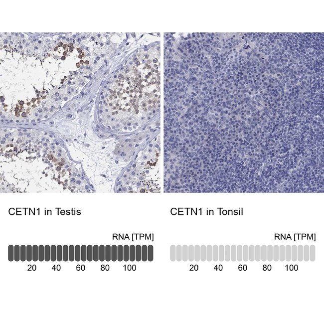 Centrin 1 Polyclonal Antibody, Invitrogen 100 μL; Unconjugated ...