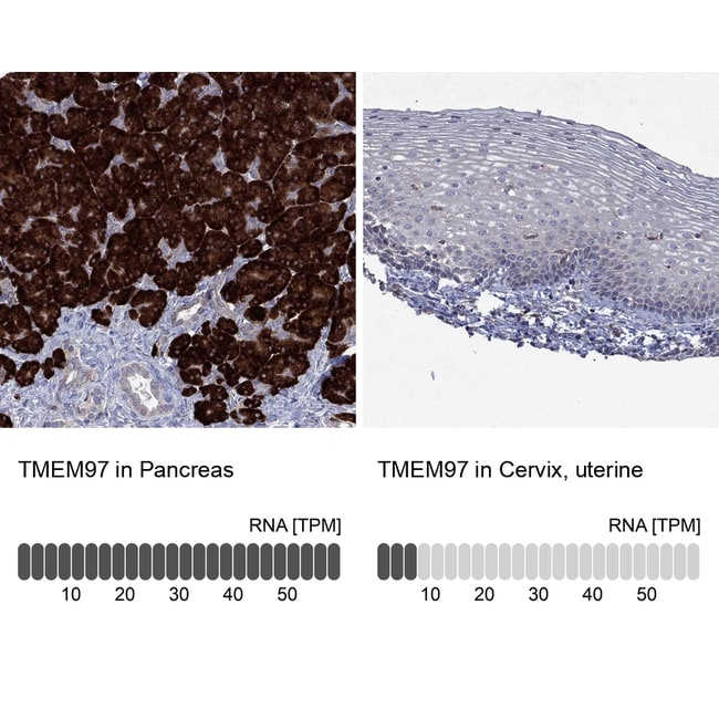 Invitrogen TMEM97 Polyclonal Antibody 100 μL; Unconjugated:Antibodies ...