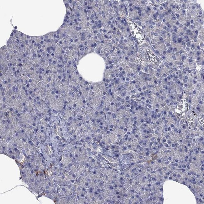 MTHFR Polyclonal Antibody, Invitrogen 100 μL; Unconjugated:Antibodies ...