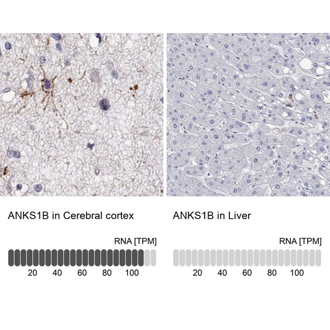 ANKS1B Polyclonal Antibody, Invitrogen 100 μL; Unconjugated:Antibodies, | Fisher Scientific