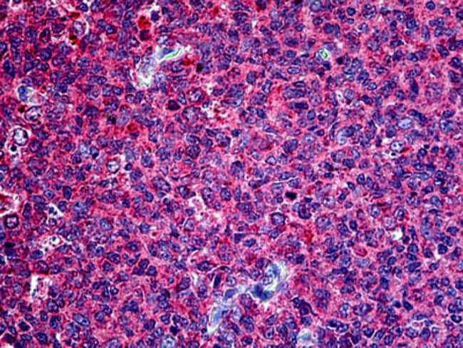 Invitrogen Securin Polyclonal Antibody 100 μg; Unconjugated:Antibodies ...