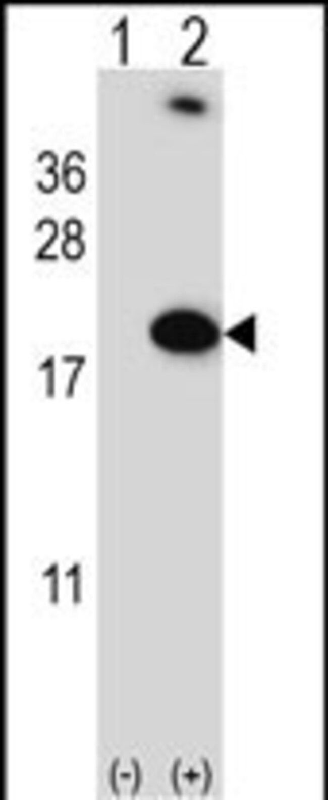 Invitrogen RBM3 Polyclonal Antibody 400 μL; Unconjugated:Antibodies ...
