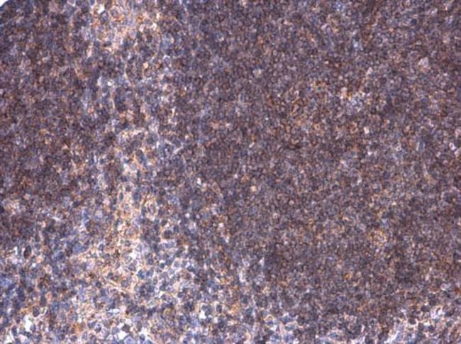 Phospho-BTK (Tyr223) Polyclonal Antibody, Invitrogen 100 μL ...