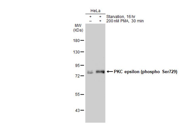 Phospho-PKC epsilon (Ser729) Polyclonal Antibody, Invitrogen 100 μL; | Fisher Scientific
