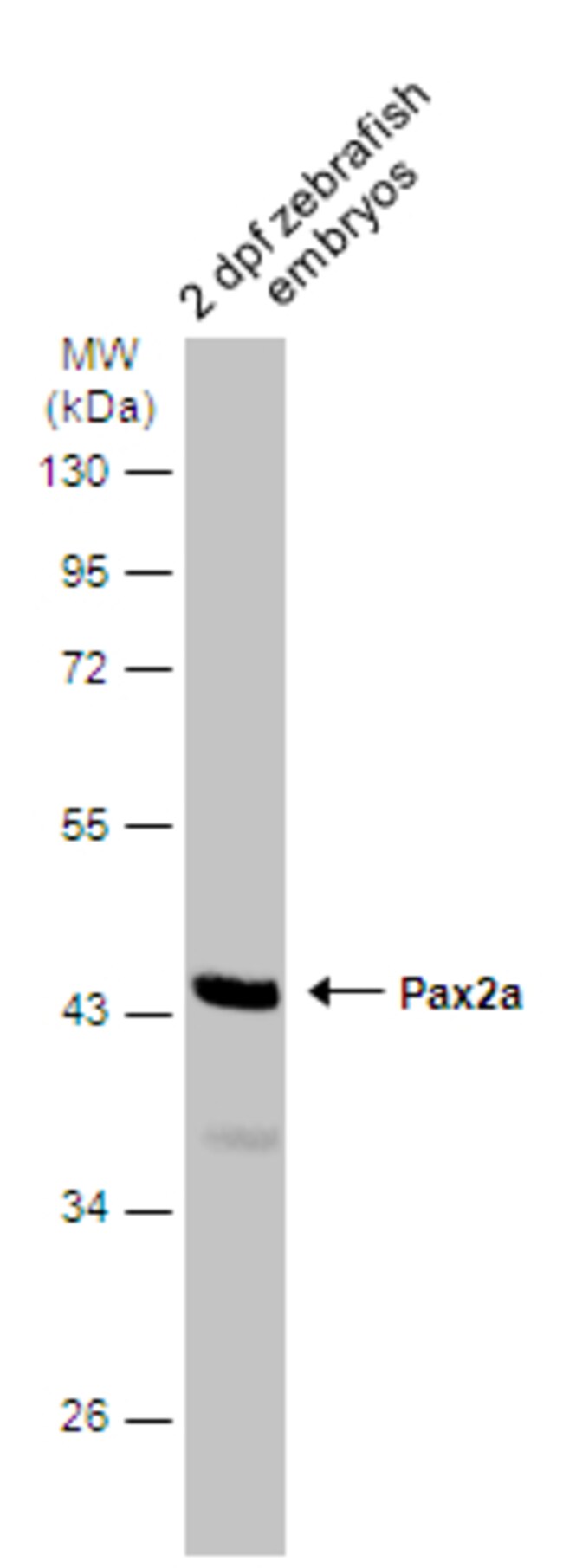 PAX2a Polyclonal Antibody, Invitrogen 100 μL; Unconjugated:Antibodies ...