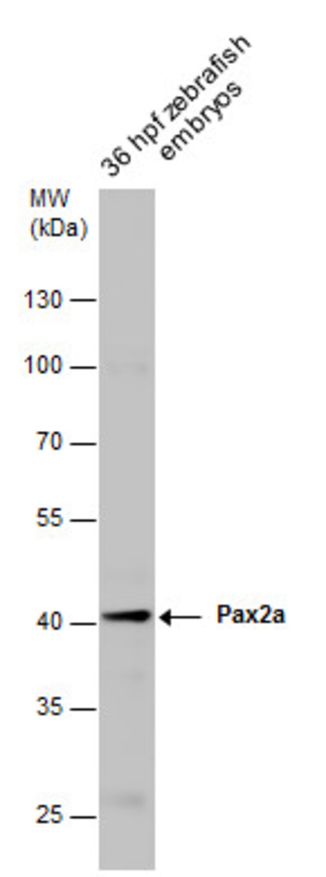 PAX2a Polyclonal Antibody, Invitrogen 100 μL; Unconjugated:Antibodies ...