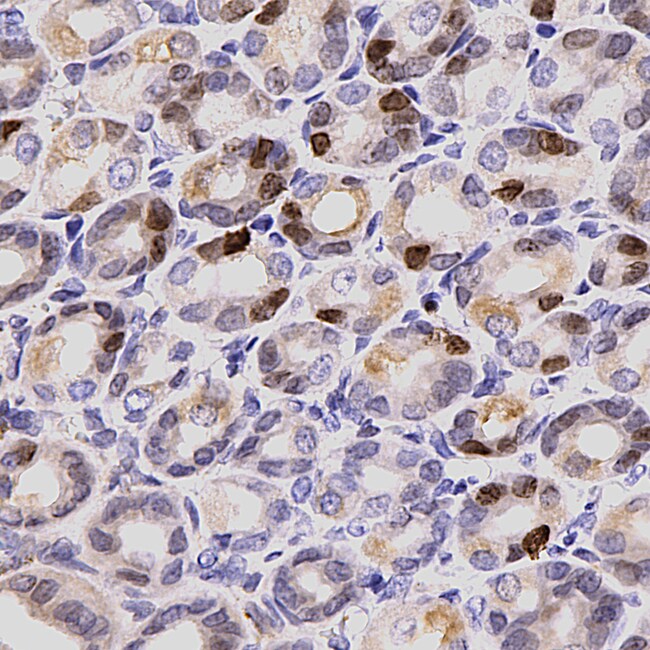 Ki-67 Polyclonal Antibody, Invitrogen 100 μL; Unconjugated:Antibodies ...