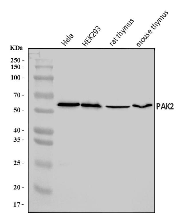 PAK2 Polyclonal Antibody, Invitrogen 100 μg; Unconjugated:Antibodies ...