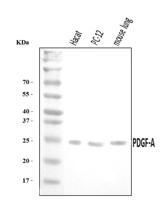 PDGF-AA Polyclonal Antibody, Invitrogen 100 μg; Unconjugated:Antibodies ...