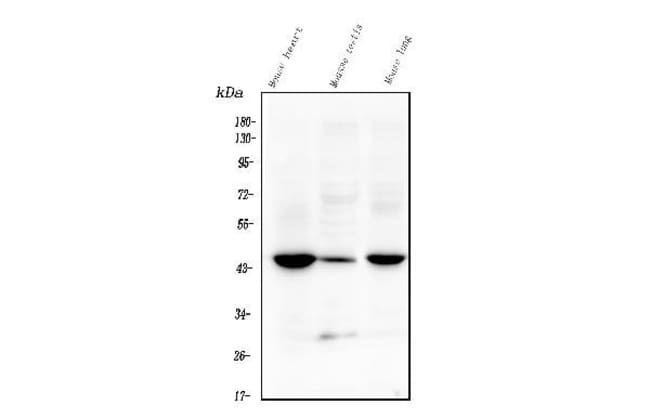 TMEM255B Polyclonal Antibody, Invitrogen 100 μg; Unconjugated ...