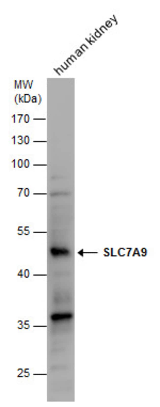 Invitrogen SLC7A9 Polyclonal Antibody 100 μL; Unconjugated:Antibodies ...