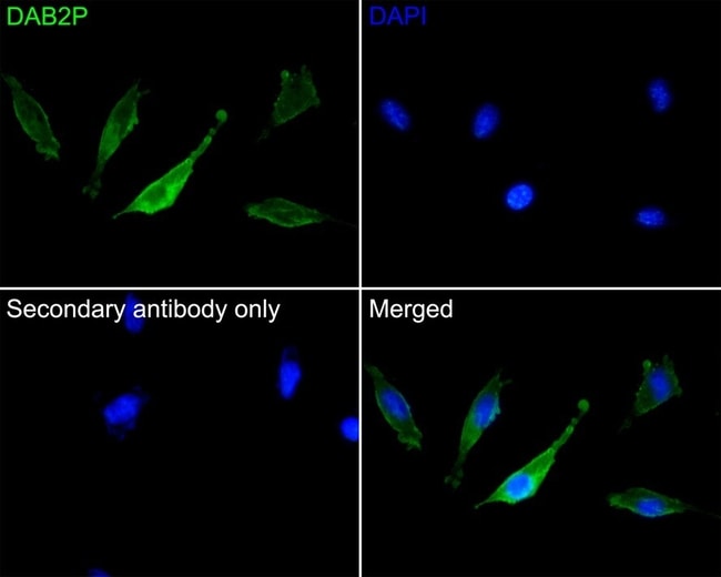 DAB2IP Polyclonal Antibody, Invitrogen 100 μL, Unconjugated:Antibodies ...