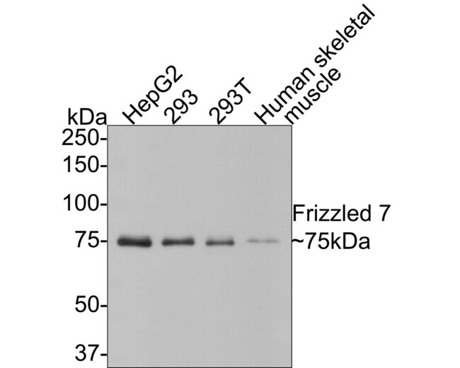 Invitrogen FZD7 Polyclonal Antibody 100 μL; Unconjugated:Antibodies ...