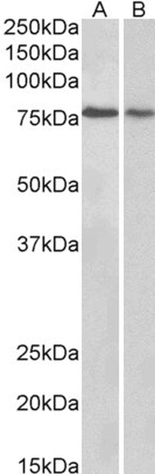 BERP Polyclonal Antibody, Invitrogen 100 μg; Unconjugated:Anticuerpos ...