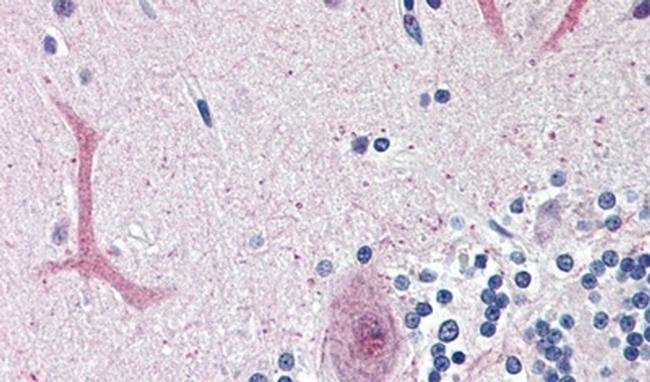 FOXC1 Goat anti-Human, Mouse, Polyclonal, Invitrogen 100 µg ...