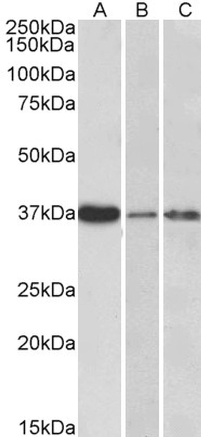 IL-12 p40 Polyclonal Antibody, Invitrogen 100 μg; Unconjugated ...