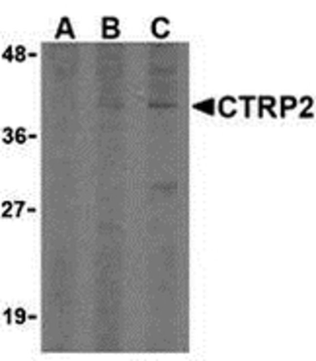 CTRP2 Polyclonal Antibody, Invitrogen 100 μg; Unconjugated:Antibodies ...