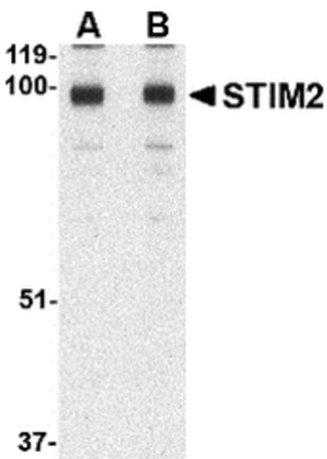 STIM2 Polyclonal Antibody, Invitrogen 100 μg; Unconjugated:Antibodies ...