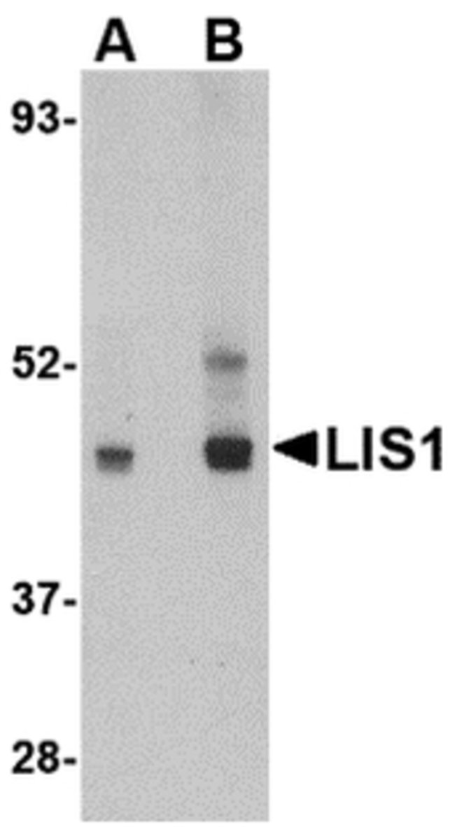 LIS1 Polyclonal Antibody, Invitrogen 100 μg; Unconjugated:Antibodies ...