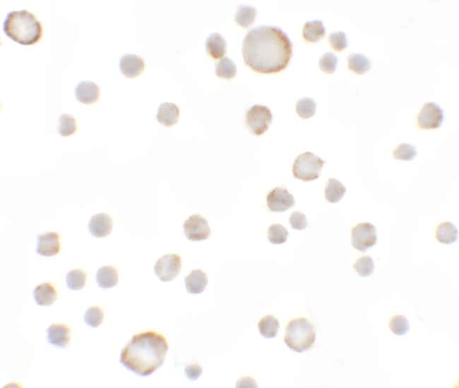 KAL1 Polyclonal Antibody, Invitrogen 100 μg; Unconjugated:Antibodies ...