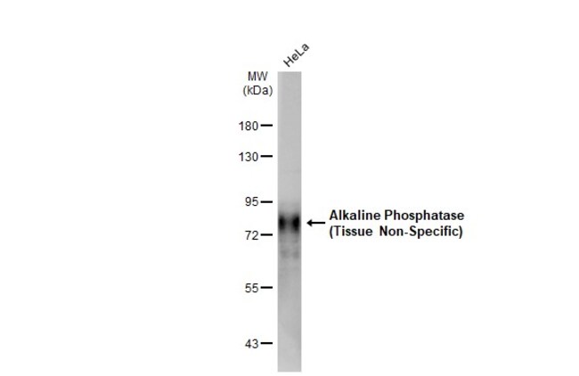 Invitrogen ALPL Polyclonal Antibody 100 μL; Unconjugated:Anticorps ...