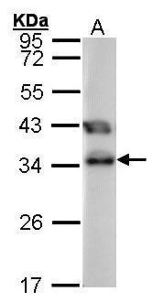 TTC1 Polyclonal Antibody, Invitrogen 100 μL; Unconjugated:Antibodies ...
