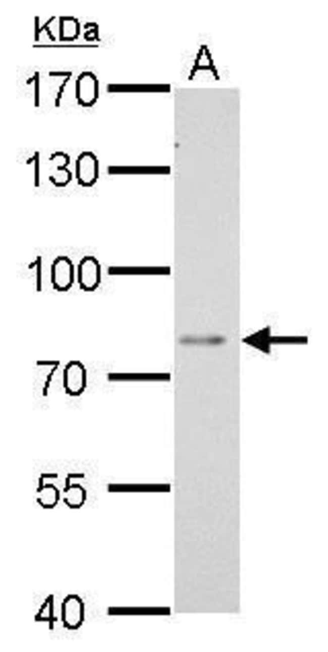 DPP3 Polyclonal Antibody, Invitrogen™ 100 μL; Unconjugated | Fisher ...