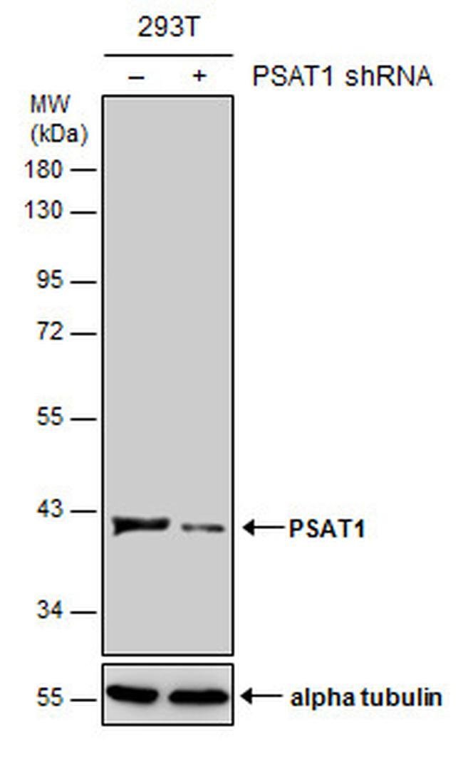PSAT1 Polyclonal Antibody, Invitrogen™ 100 μL; Unconjugated | Fisher ...