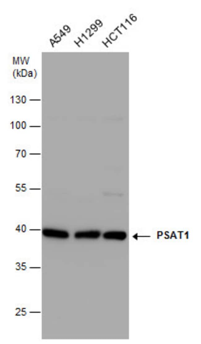 PSAT1 Polyclonal Antibody, Invitrogen™ 100 μL; Unconjugated | Fisher ...