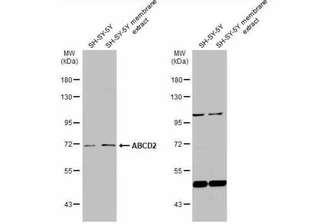 Invitrogen ABCD2 Polyclonal Antibody 100 μL; Unconjugated:Antikroppar ...