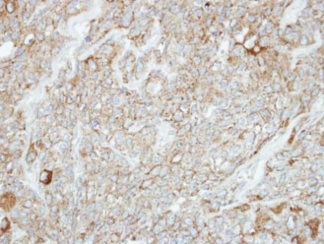 PCDH1 Polyclonal Antibody, Invitrogen 100 μL; Unconjugated:Antibodies ...